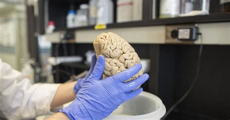 Scientists Find Clue To Reasons For Age Related Memory Loss CBS News