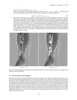 Long Bone Fracture Detection Using Artificial Neural Networks Based On