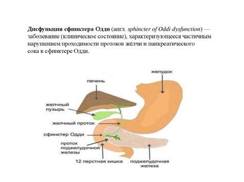 Дисфункция сфинктера Одди презентация онлайн