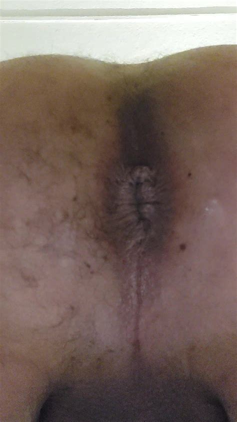 Speculum Fun 24