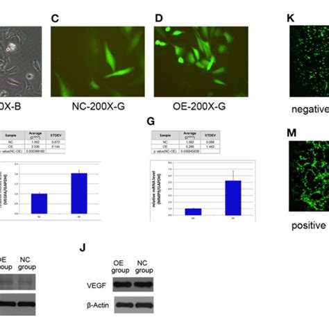 Vegf Mmp 9 Expression Increased In Asthmatic Mice A D Expression