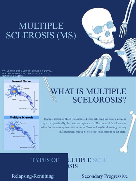 Multiple Sclerosis Pdf Multiple Sclerosis Neurological Disorders