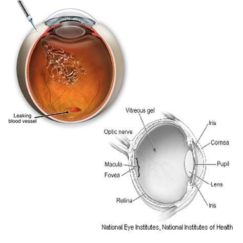 EyeCell | Microcurrent devices for treating eye related diseases