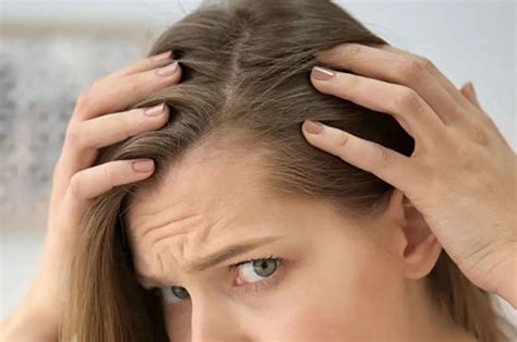 Thyroid Hair Loss