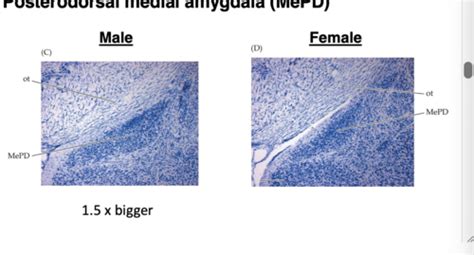 Sla Sex Differences 1 L 2 1 Flashcards Quizlet