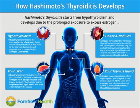Hashimotos Thyroiditis Skin