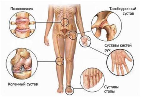 Первая помощь при вывихе - Компания Автомедик - Киев
