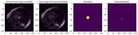 Set Up Tensorflow Mri — Tensorflow Mri Documentation