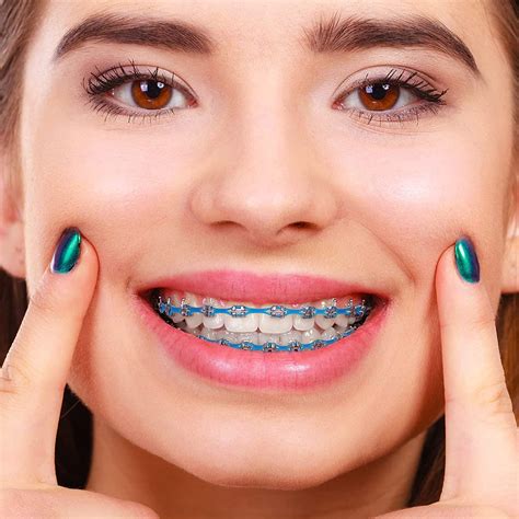 Annhua Dental Orthodontic Elastic Chain Light Blue Size 2 15ft Continuous Roll Buy Now