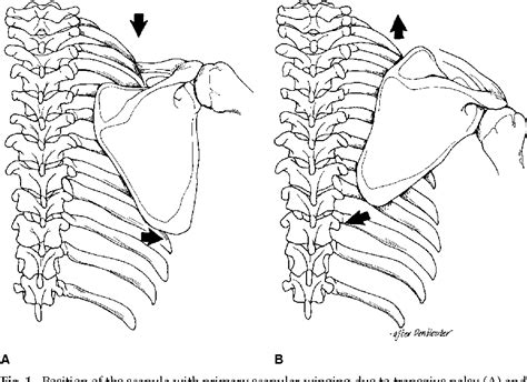 Winged Scapula Serratus Anterior