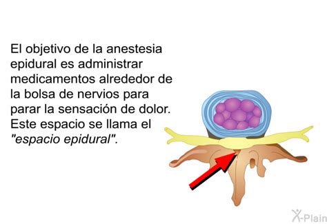 PatEdu Anestesia Epidural