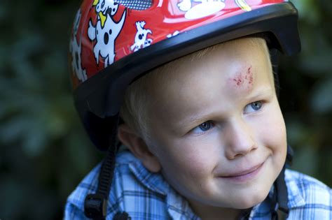 Cómo Actuar Si Tu Hijo Se Hace Una Herida Revista Pediatría Y Familia