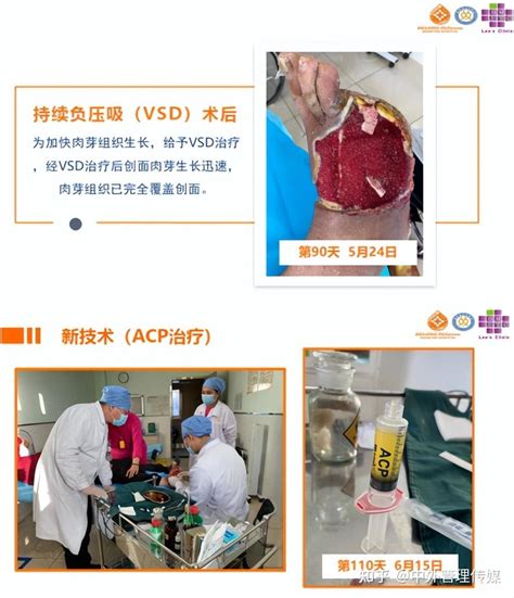 共照、共创、共享丨第十一届糖尿病学术盛宴成功举办，共照之路再起新篇 知乎