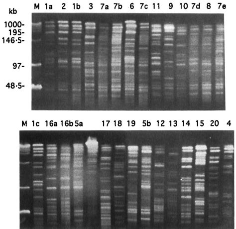chromosomal analysis by pfge digestion of dna from a baumannii with