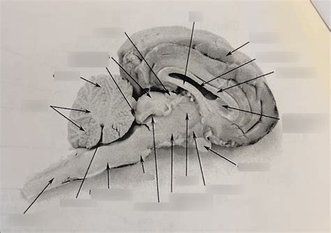 Sheep Brain Saggital View Diagram Quizlet