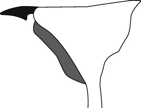 Hip Anatomic Variants That May Mimic Abnormalities At Mri Labral