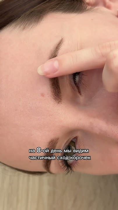 Как заживает татуаж Корочки после татуажа бровей Youtube