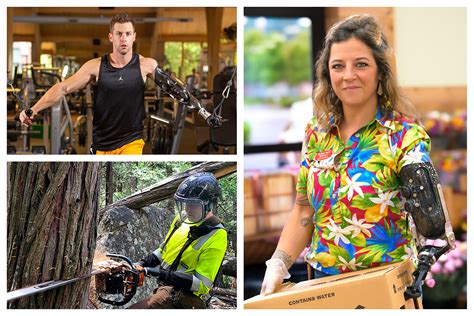 The Upper Limb Library