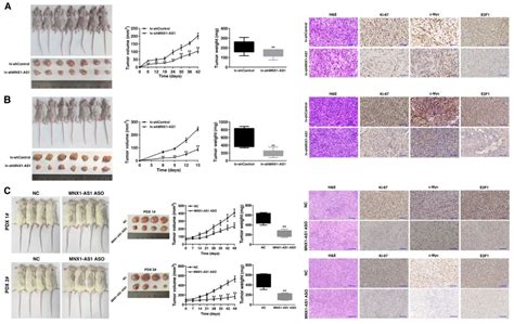 Cancer Research丨lncRNA MNX AS 通过促进IGF BP 的相分离驱动肺癌细胞的肿瘤发生 企业动态 丁香通