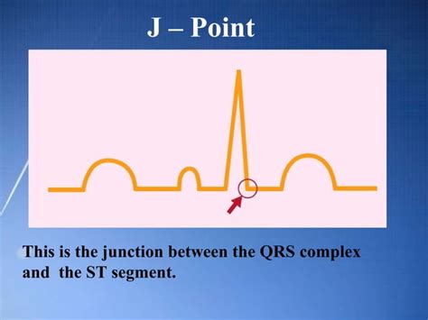 Ecg Basic Guidelines Ppt