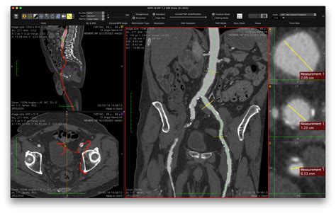 Osirix Dicom Dascp