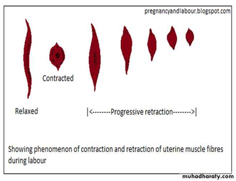 What Is Retraction Of Uterus At Michael Danforth Blog