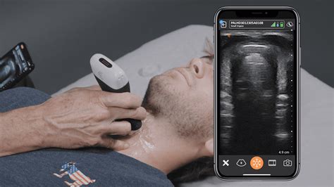 Pocus To Confirm Endotracheal Tube Placement Clarius