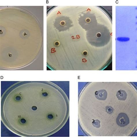 A Antibacterial Assay Regarding Solanum Nigrum Extract Inhibiting Download Scientific