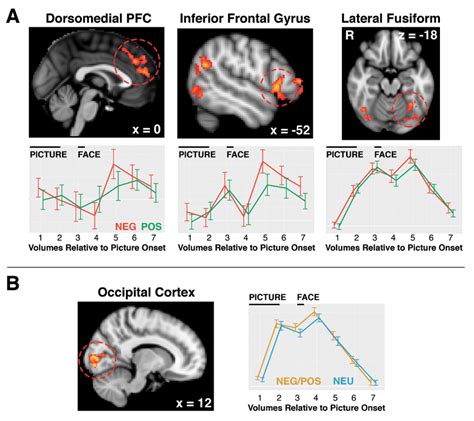 A Whole Brain Voxelwise Analysis For The Valence Contrast Revealed Download Scientific