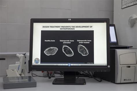 Using The Experiment Into Microgravity On Board The International Space Station It Is Possible