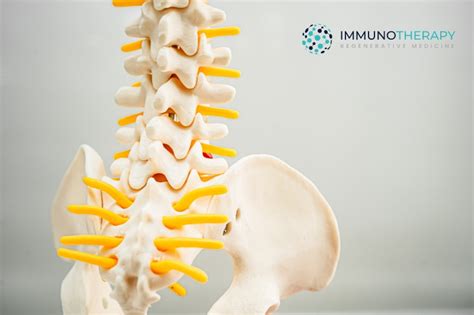 Stem Cell Therapy For Degenerative Disc Disease In Mexico