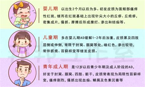 儿童特应性皮炎的 硬核”日常护理 知乎