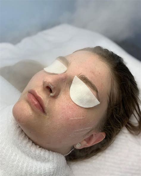 Lizskincare Clinic On Instagram Our Deep Cleansing Facial Includes