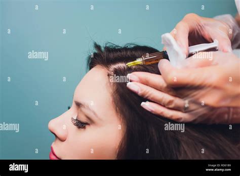 Platelet Rich Plasma Injection Procedure Hair Growth Stimulation Prp