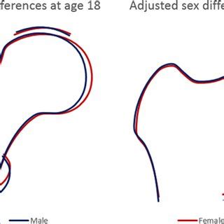 Sex Differences In Hip Shape At Age 14 Based On The Difference In Mean Download Scientific