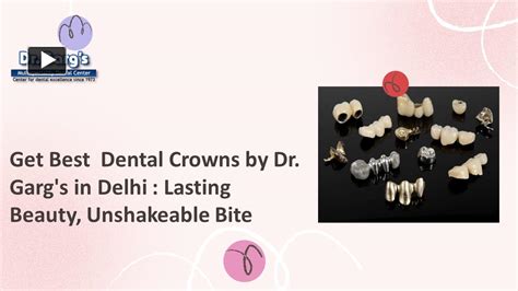 Ppt Get Best Dental Crowns By Dr Gargs In Delhi Lasting Beauty