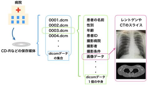 Dicomデータとはなにか｜医療のためのpythonプログラミング