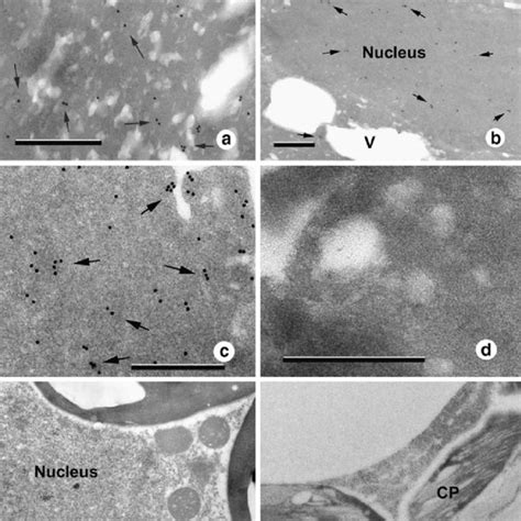 Immunogold Labeling Of A Peppermint Peltate Glandular Trichome