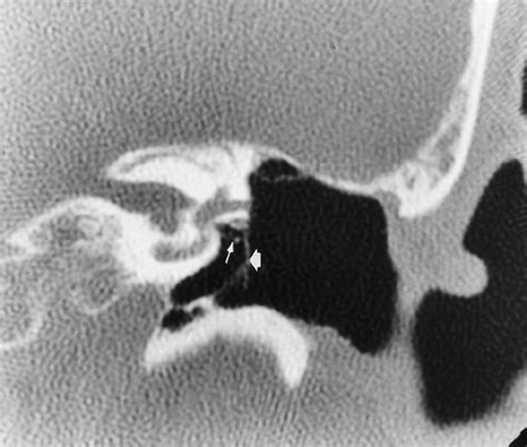 The Temporal Bone Radiology Key