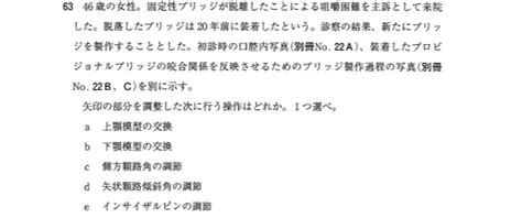 116回歯科医師国家試験116B 63歯冠補綴学インサイザルテーブル編 歯学部オンライン予備校TIDブログ歯科材料のツボ