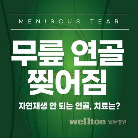 반월상연골손상 자연재생되지 않는 무릎연골 찢어짐 수술 네이버 블로그