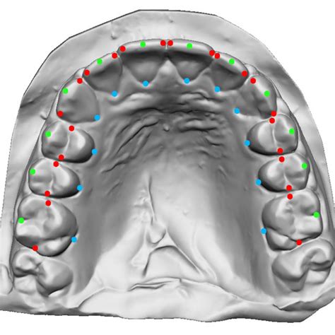 Measurements Recorded A Arch Depth B Arch Perimeter C Anterior Download Scientific