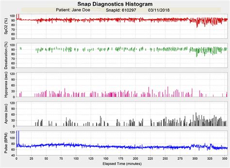 Sleep Histogram Snap Diagnostics Llc