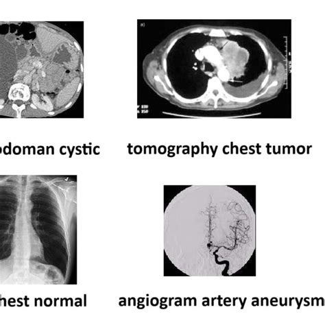 Example Of Random Images From The Dataset And Their Respective Download Scientific Diagram