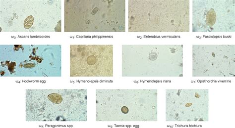 Figure 1 From Attention Driven Retinanet For Parasitic Egg Detection Semantic Scholar