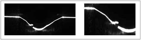 【深度学习】焊缝检测【附完整链接】label焊缝 Csdn博客