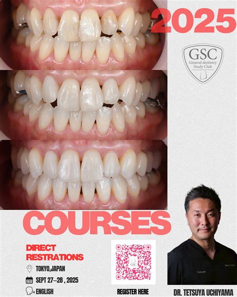 Doctorbook 🦷 Direct Restorations Using A Microscope And Rubber Dam