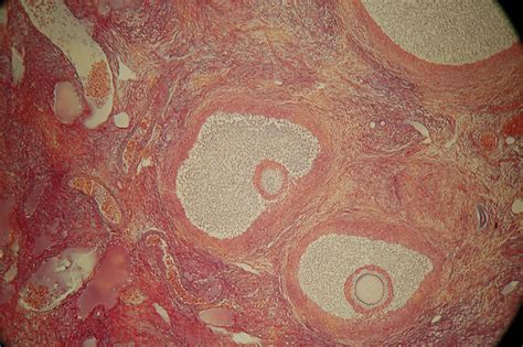 Cat Ovary Diagram Quizlet