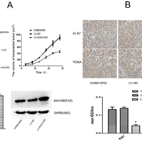 Kiaa1456 Suppresses The Growth Of Epithelial Ovarian Cancer In Vivo