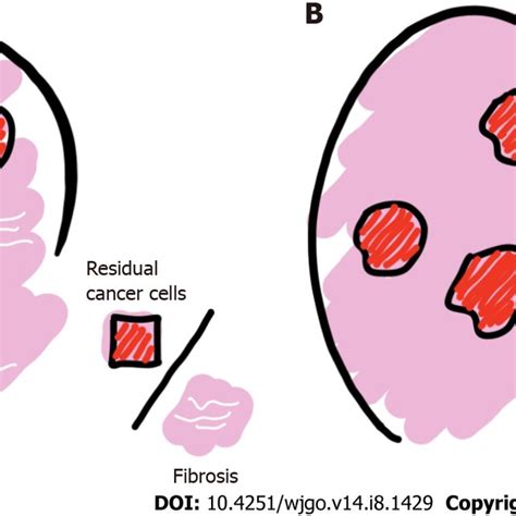 Principles Of Lymph Node Regression Grade Assessment A Ratio Of